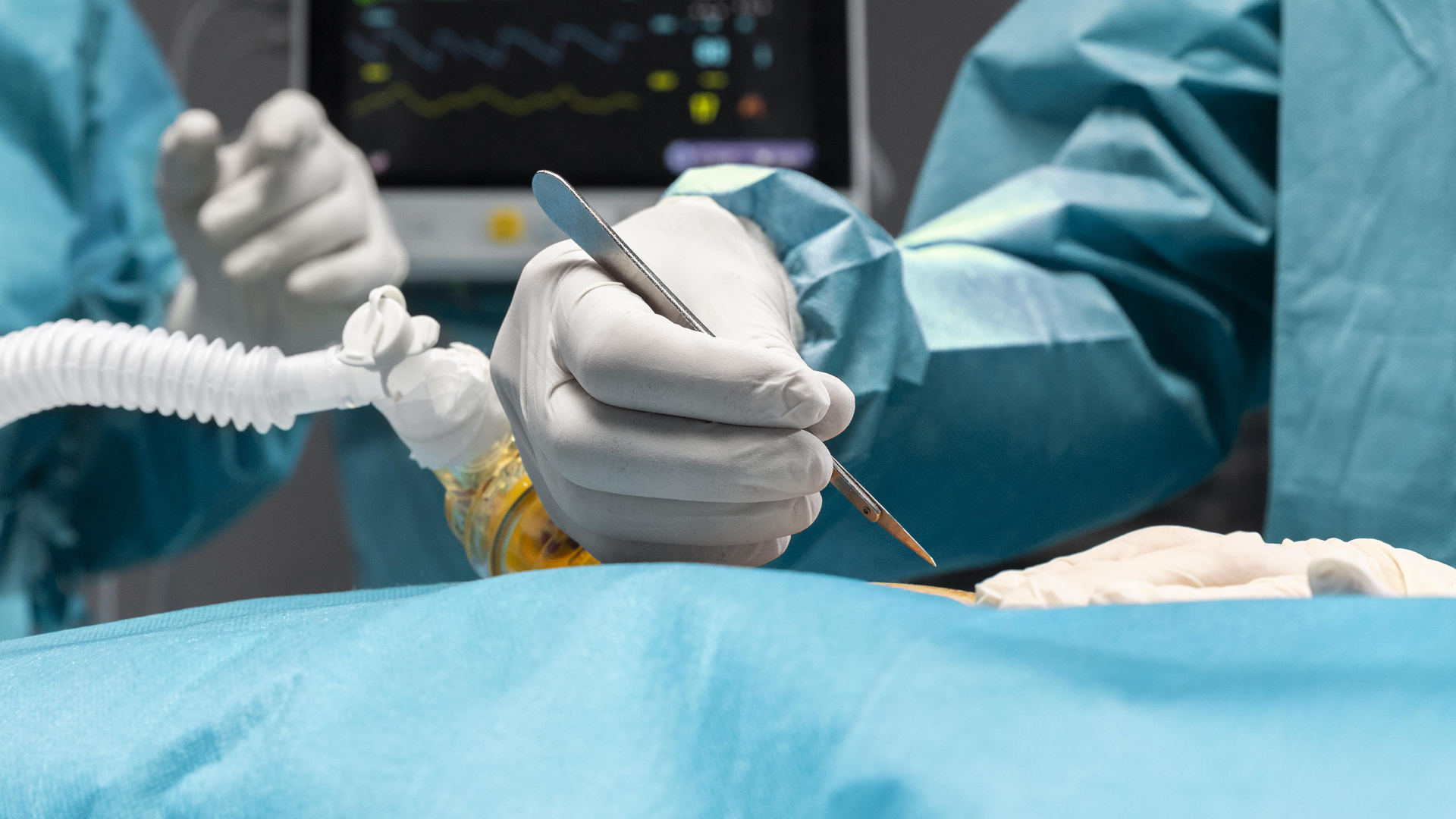 Abdominal and thoracic surgery - rimsa